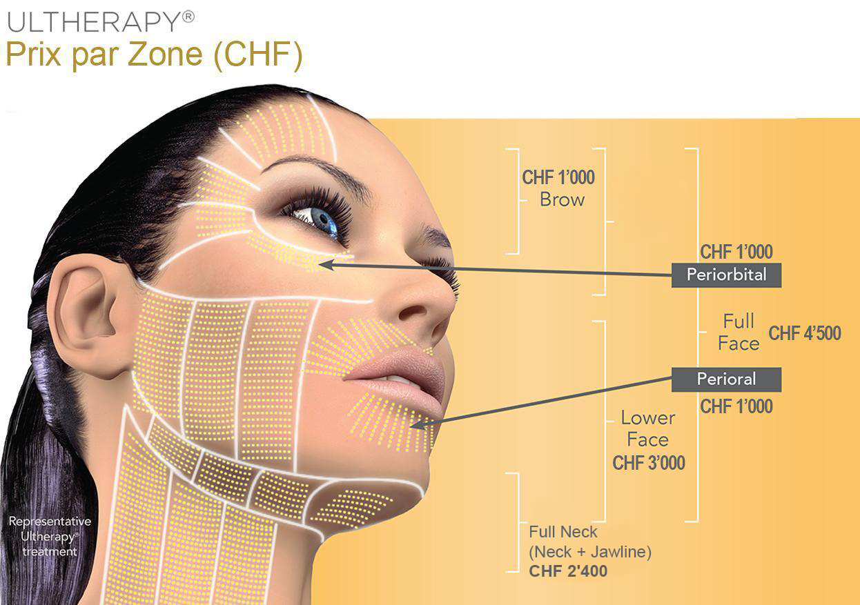 ULTHERAPY - Clinique esthétique à Genève, Suisse | Dr. Nasser Madi